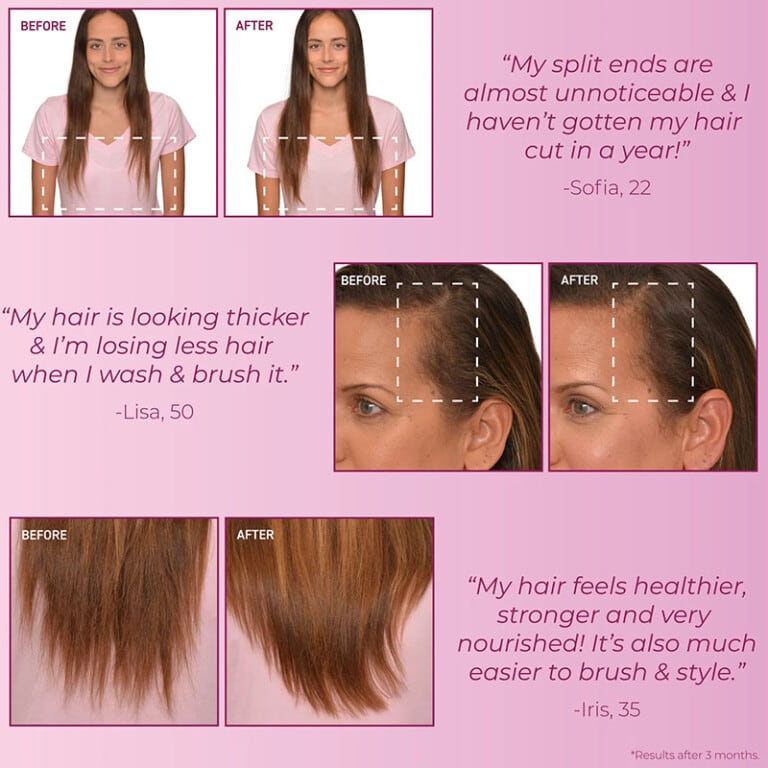 Bosley MD MendXtend Leave-In Treatment, 100ml - Hairhouse Warehouse